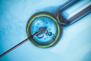 ICSI (Intracytoplasmic Sperm Injection) | LLU Center for Fertility