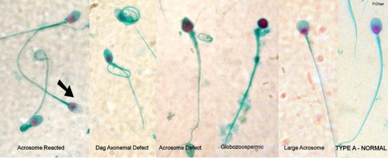 Andrology Lab | Loma Linda University Fertility Center